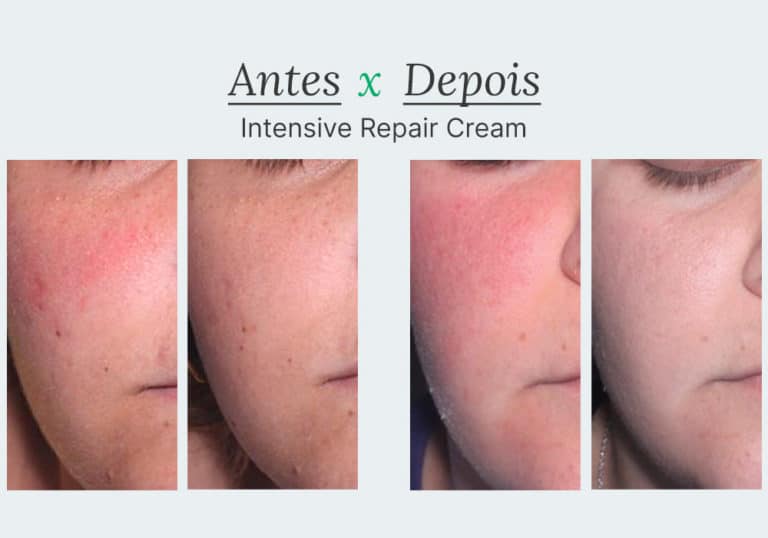 Hidratante Intensive Repair Cream: conheça o novo Creamy