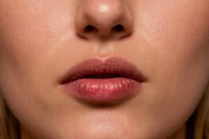 Descubra quais as causas dos lábios ressecados e como tratá-los